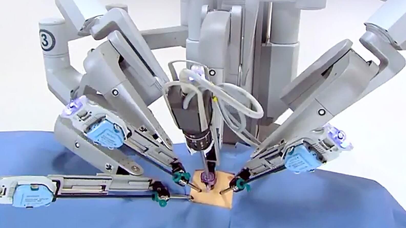 How Robots Going to Improve Medicine?